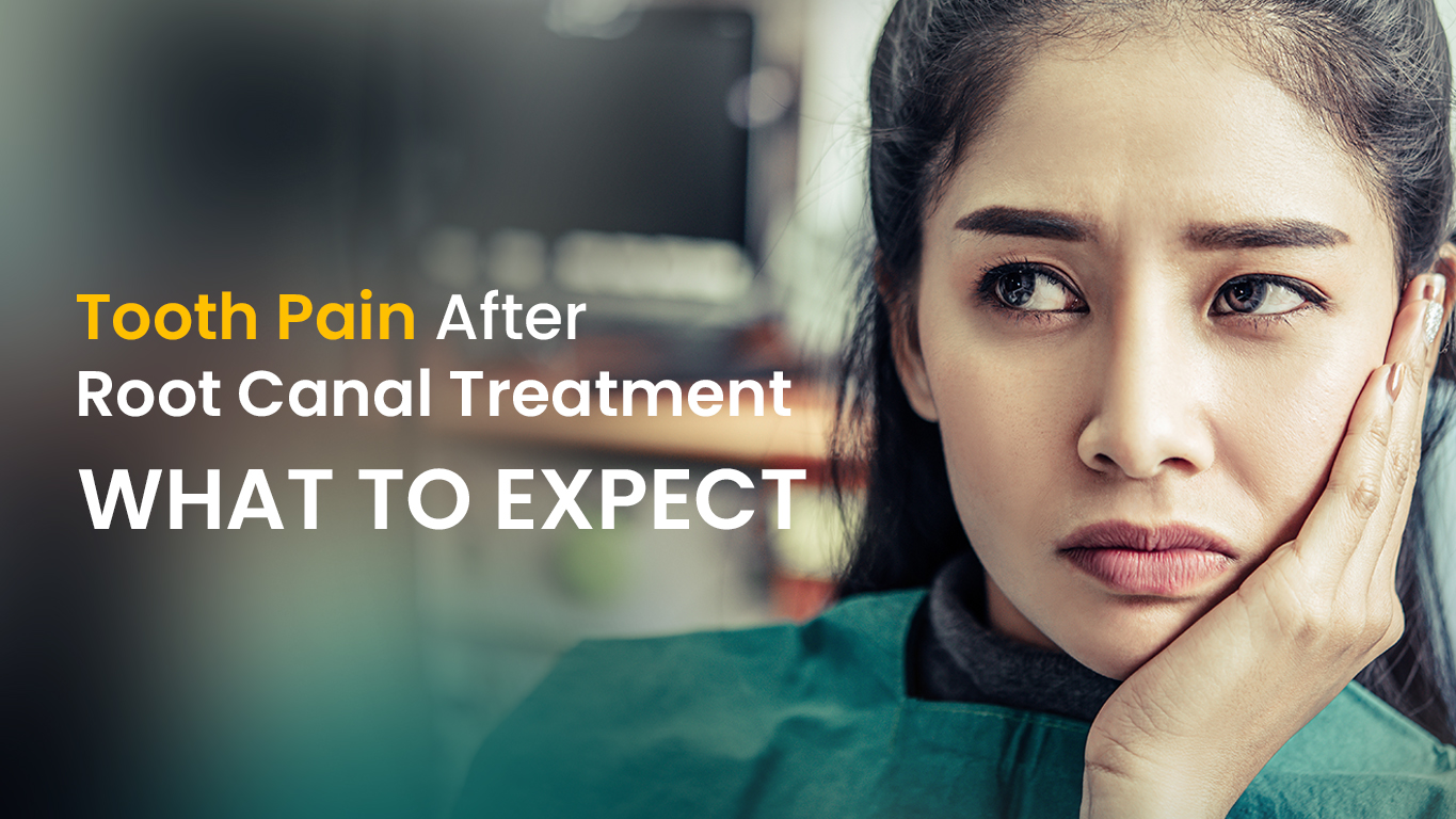 Tooth Pain after Root Canal Treatment: What to Expect | Blog